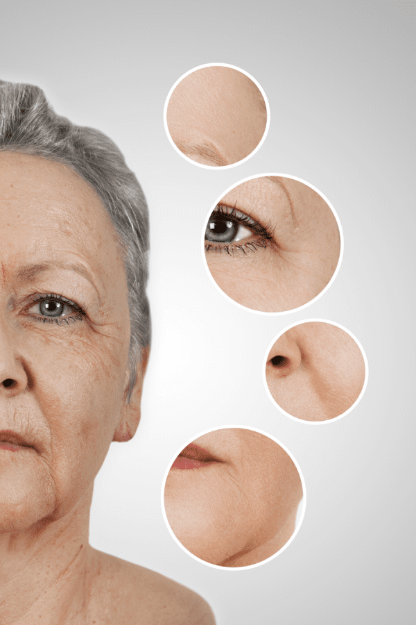 Anti Wrinkle Injection - Your Magnificence SKINDSTNY!